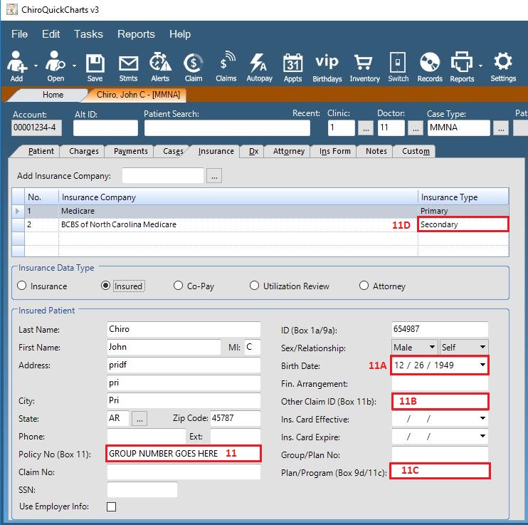 Where does Box 11 come from – Epic Support from DBC